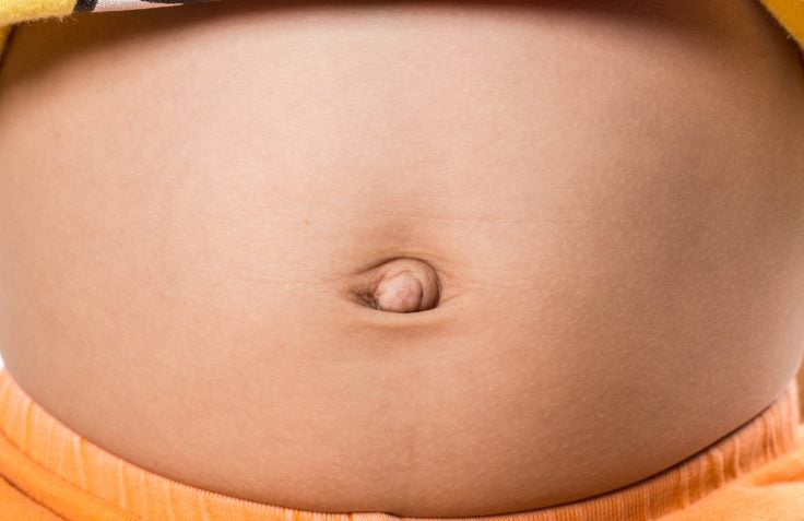 Il existe 6 types de nombrils, voici ce que le vôtre dit de vous
