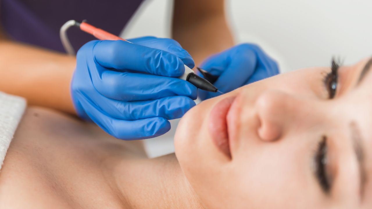 Poils au menton : cette technique est la pire méthode d'épilation selon ...