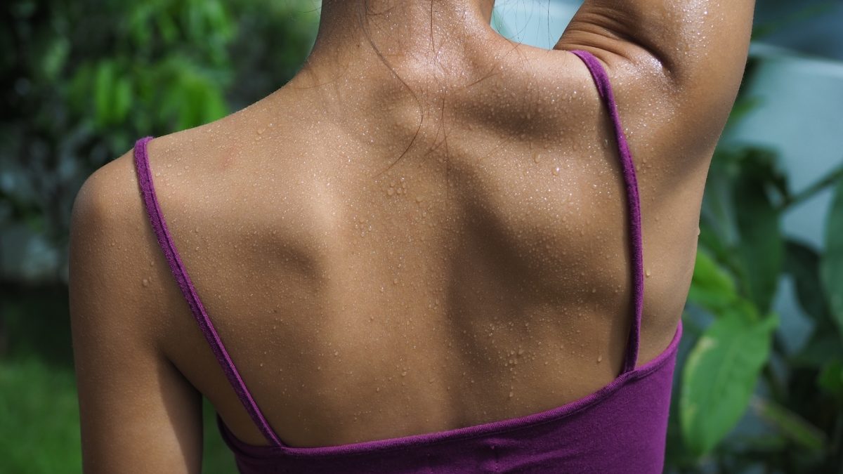 Fini la transpiration du dos : 3 solutions miracle pendant la canicule